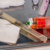 Betekenis BSE bezinking bloedonderzoek